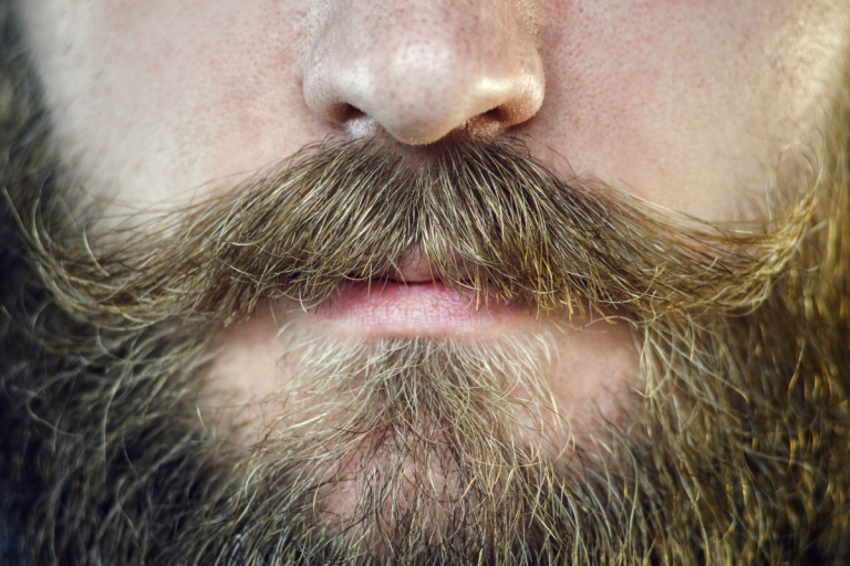 The Top Reasons Hair Doesn’t Grow in the Middle of the Mustache ...